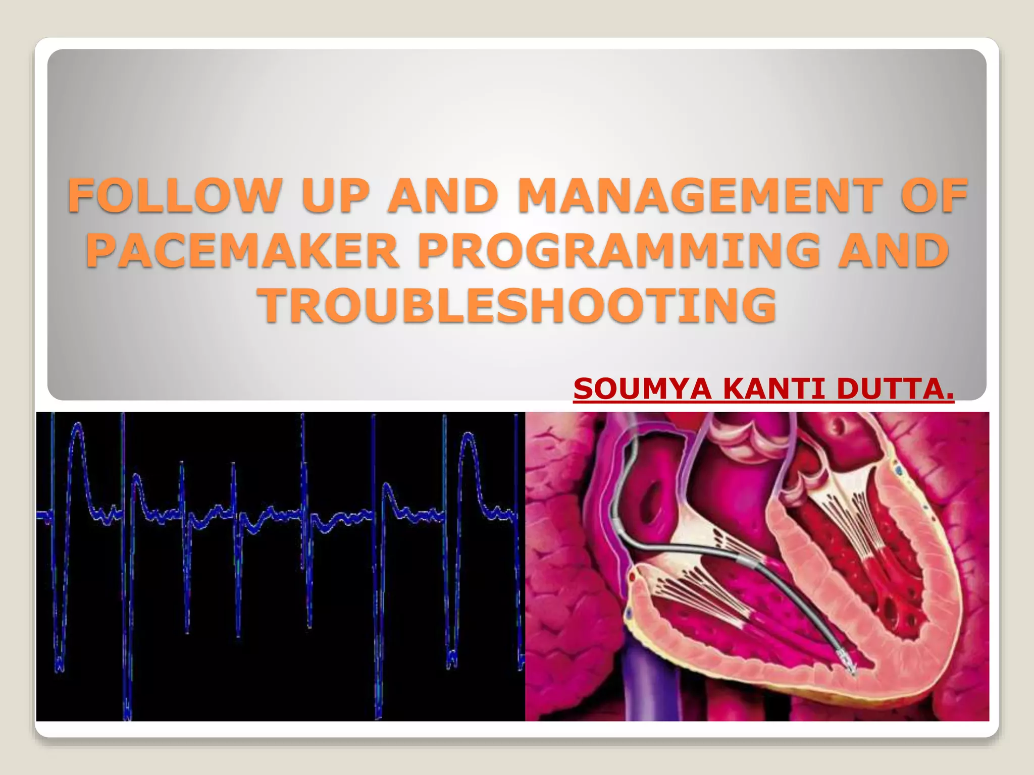 Follow up and management of pacemaker programming and | PPTX
