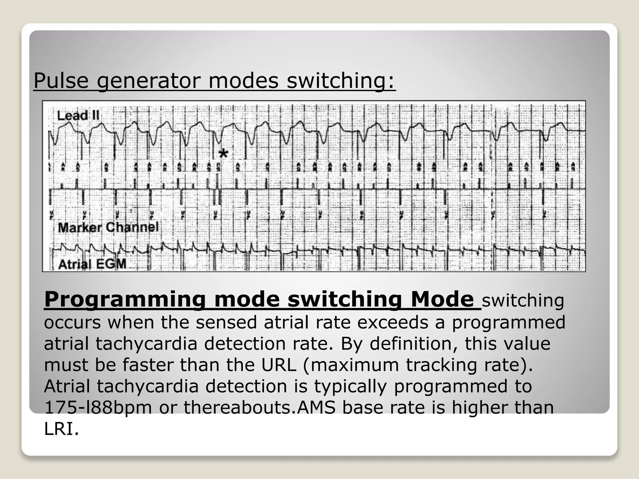 Follow up and management of pacemaker programming and | PPTX
