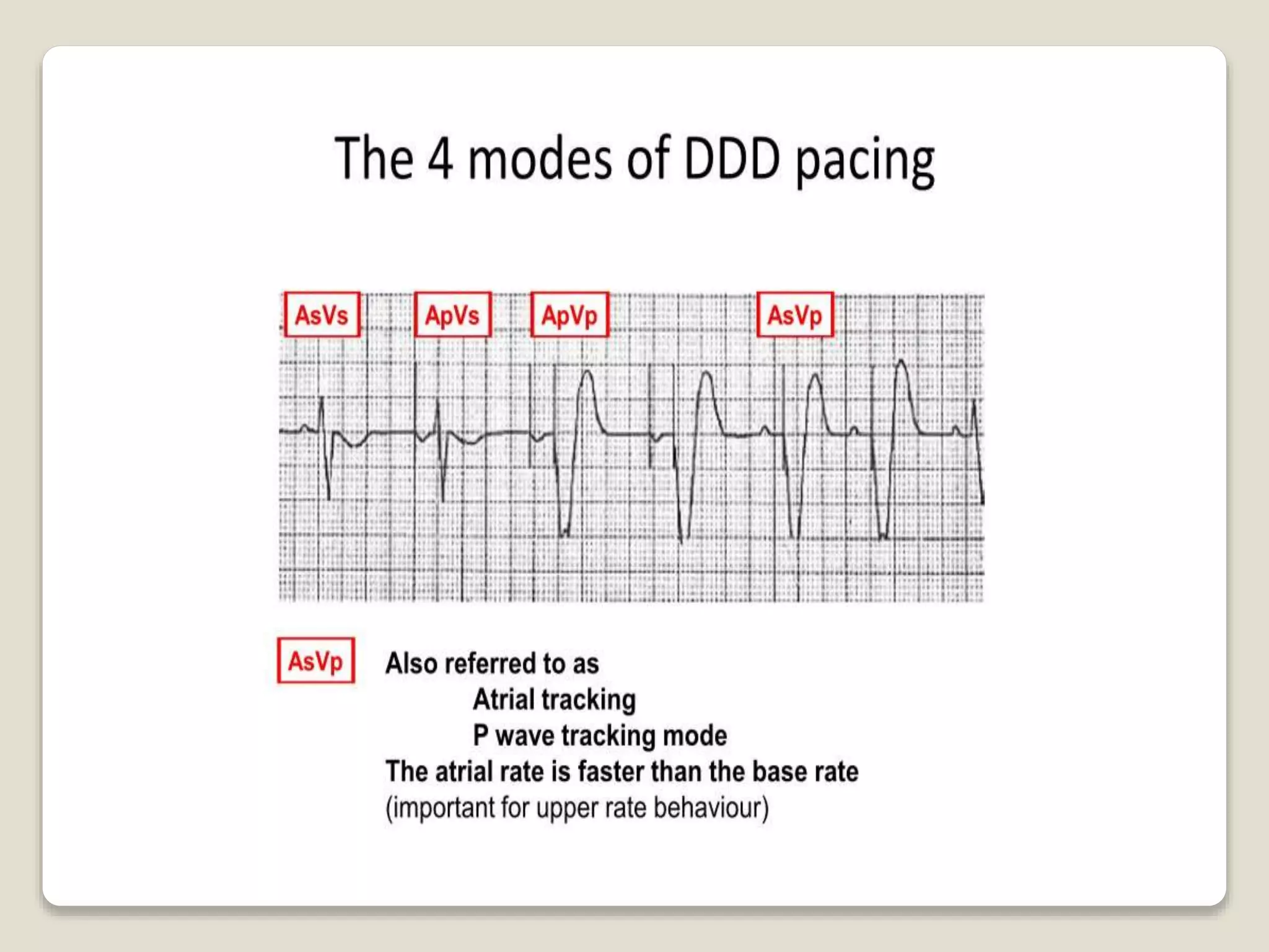 Follow up and management of pacemaker programming and | PPTX
