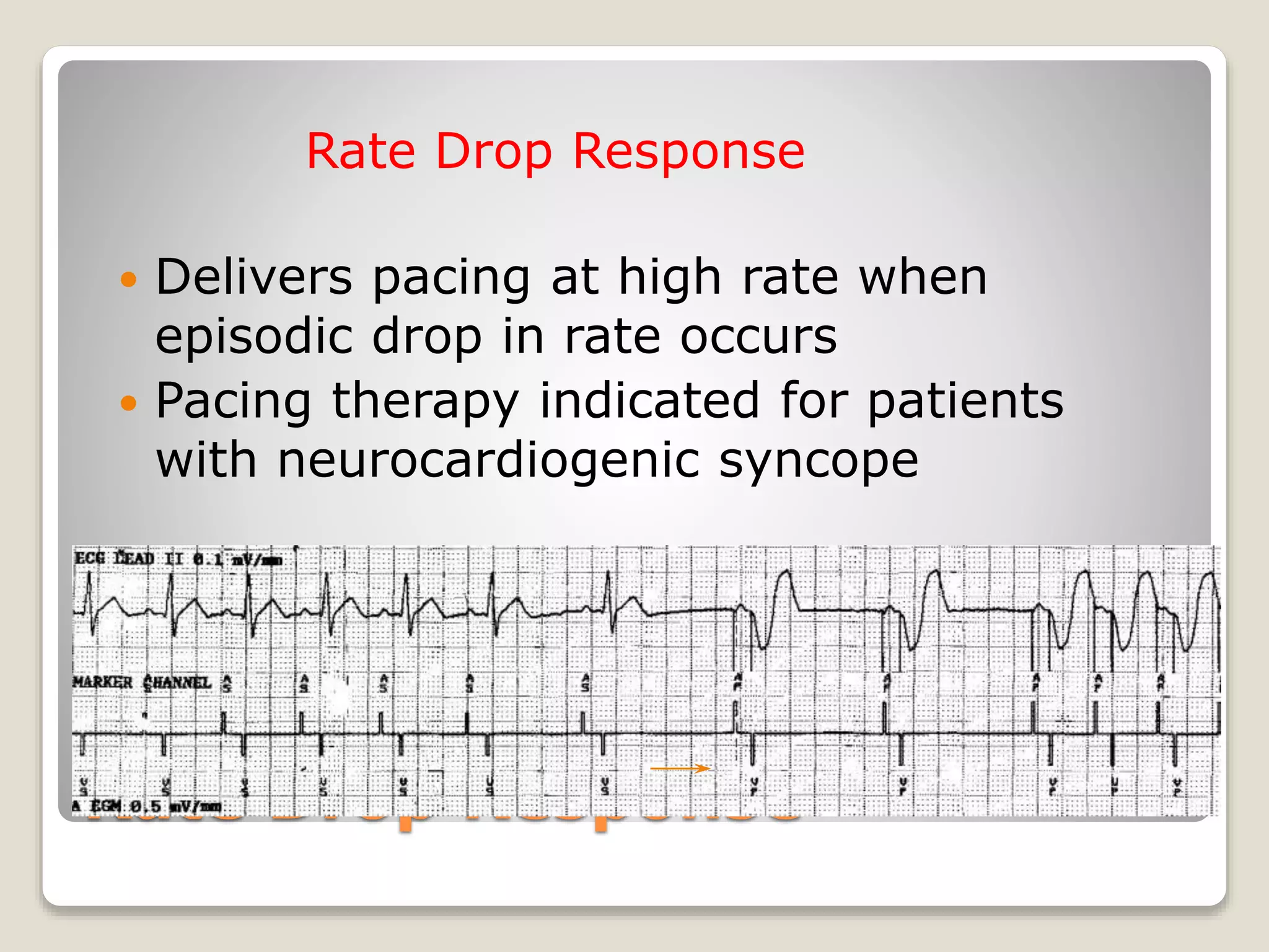 Follow up and management of pacemaker programming and | PPTX