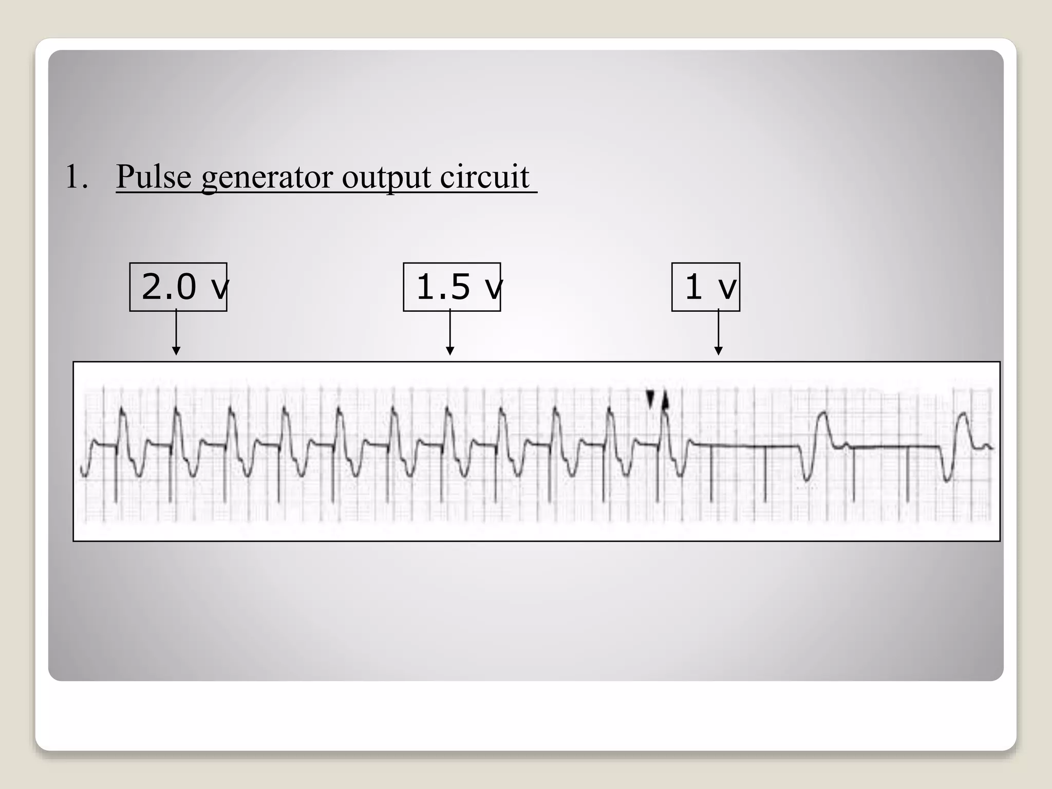 Follow up and management of pacemaker programming and | PPTX
