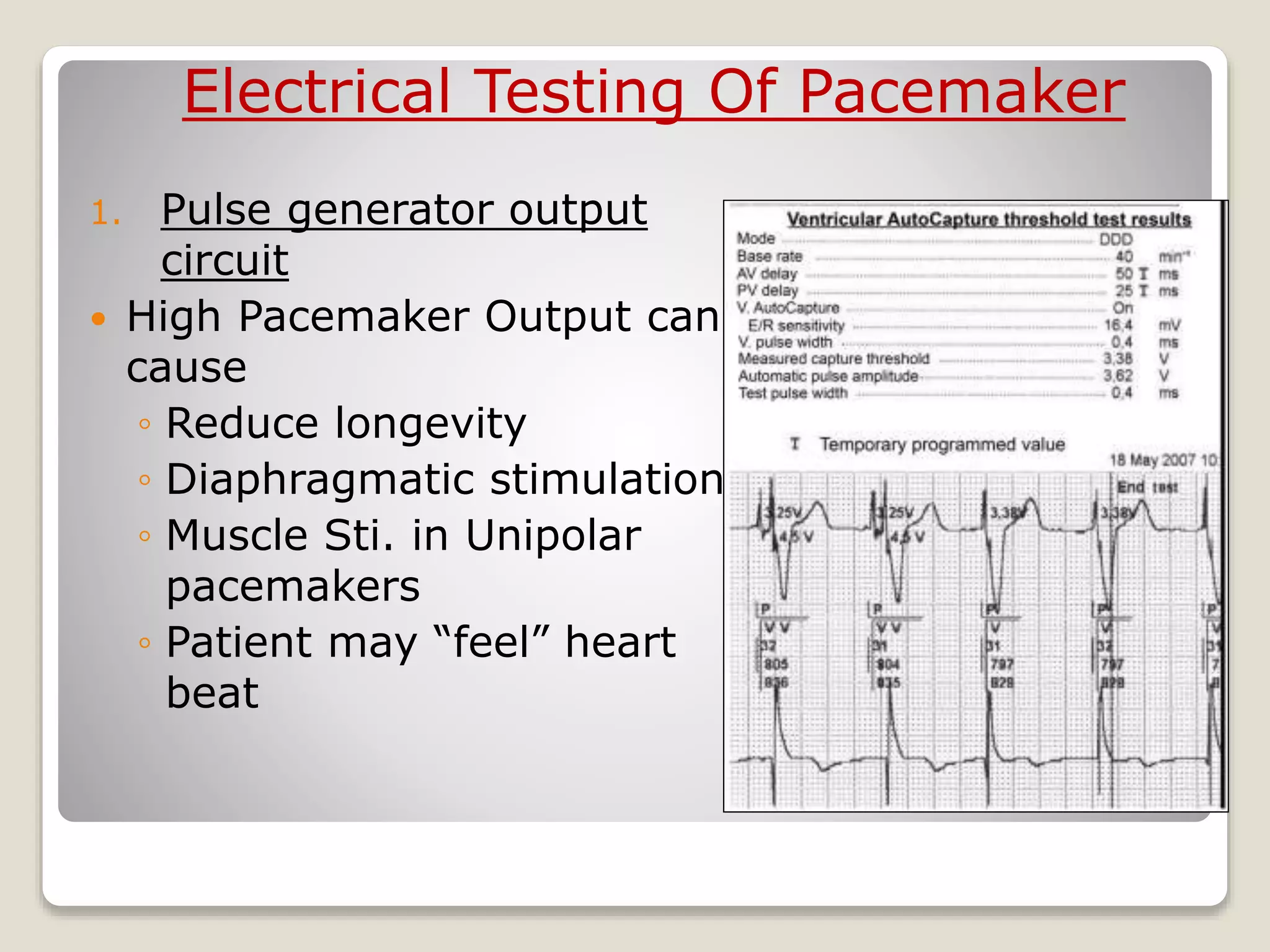 Follow up and management of pacemaker programming and | PPTX