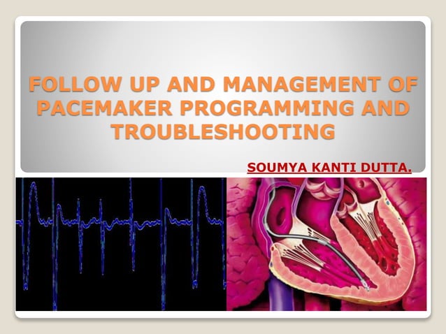 Follow up and management of pacemaker programming and | PPTX