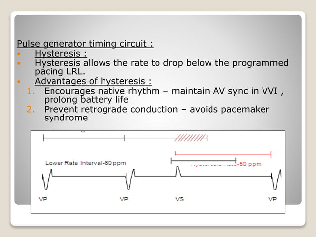 Follow up and management of pacemaker programming and | PPTX
