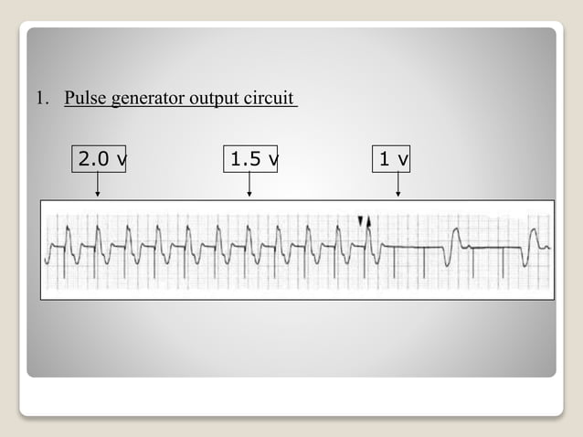 Follow up and management of pacemaker programming and | PPTX