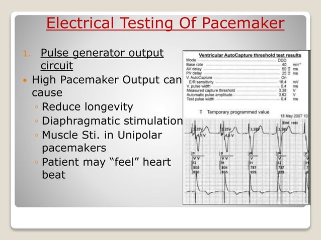 Follow up and management of pacemaker programming and | PPTX