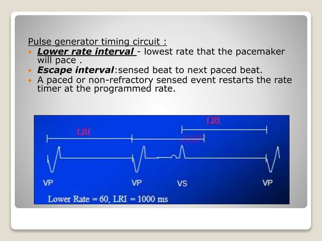 Follow up and management of pacemaker programming and | PPTX
