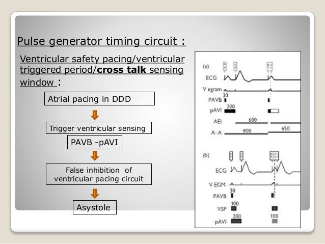 Follow up and management of pacemaker programming and