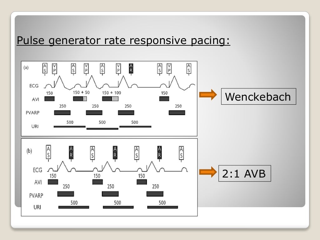 Follow up and management of pacemaker programming and