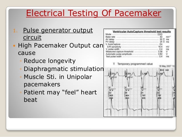 Follow up and management of pacemaker programming and