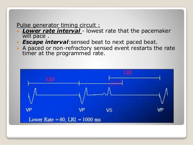 Follow up and management of pacemaker programming and