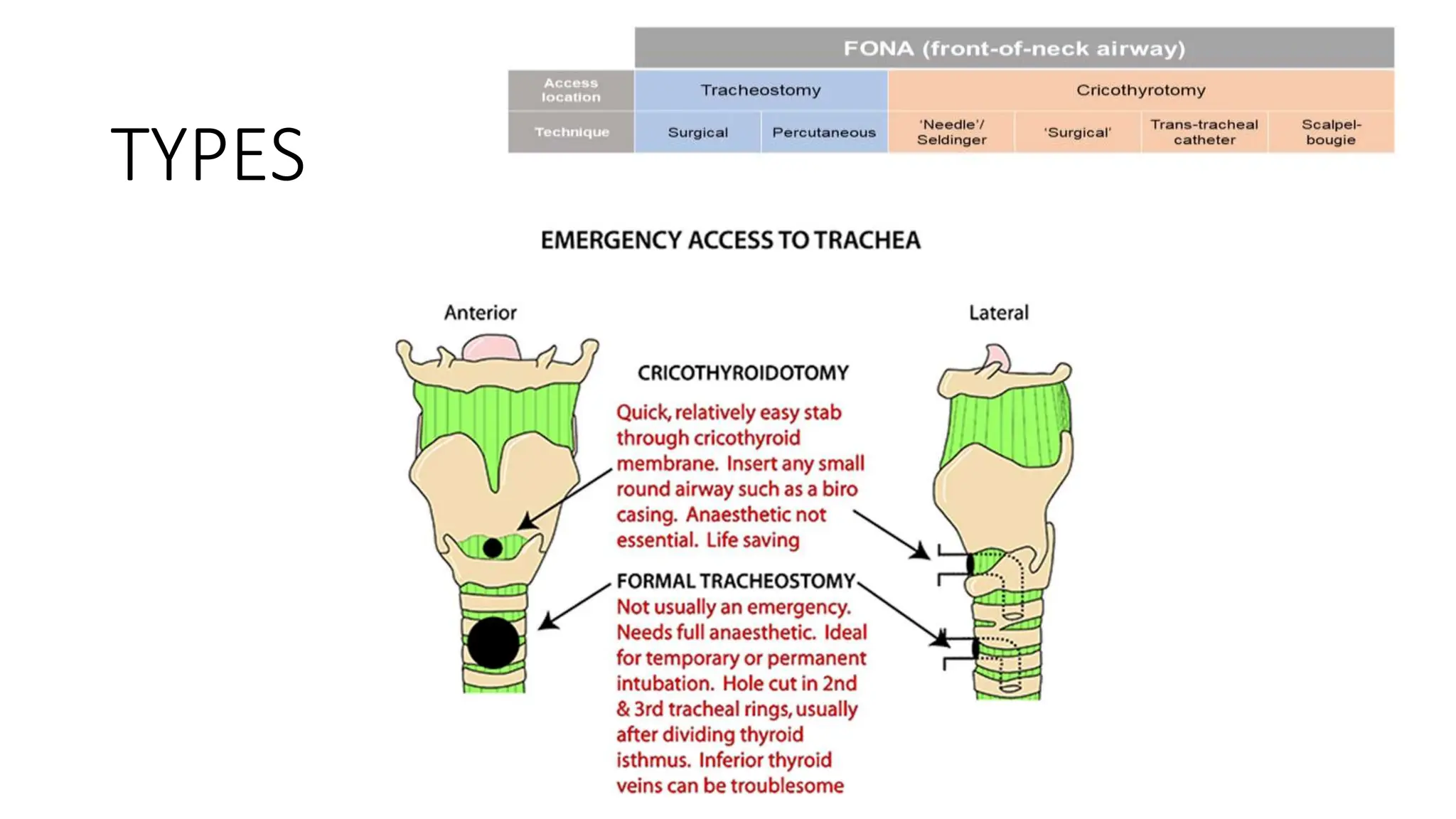 Front of neck access for difficult airway | PPTX