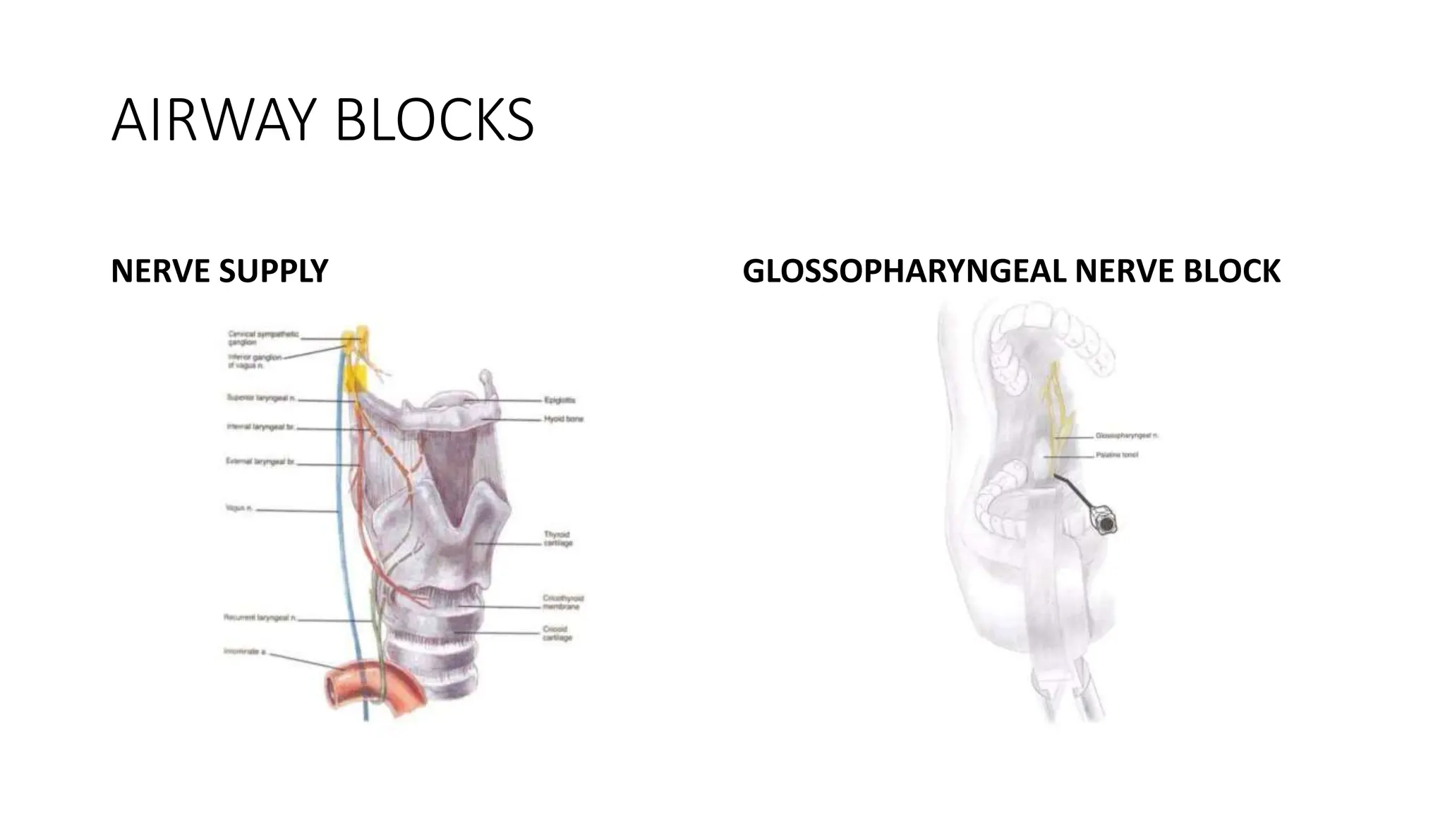 Front of neck access for difficult airway | PPTX