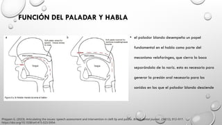 FONOAUDIOLOGIA EN PACIENTES CON LABIO PALADAR HENDIDO.pptx