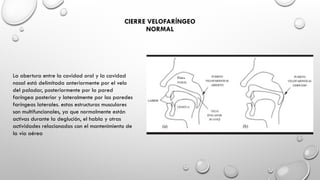 FONOAUDIOLOGIA EN PACIENTES CON LABIO PALADAR HENDIDO.pptx