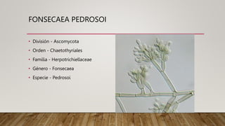 FONSECAEA PEDROSOI AGENTE CAUSAL DE LA CROMOBLASTOMICOSIS | PPT