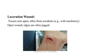 FON skin management (1).pptx