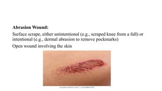 FON skin management (1).pptx