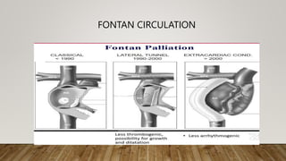 JULIETH KABIRIGI,PAED.CARDIOLOGIST-CUHAS | PPTX