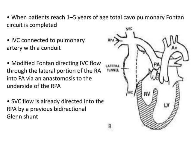 Fontan procedure | PPTX | Heart and Cardiovascular Diseases | Diseases and Conditions