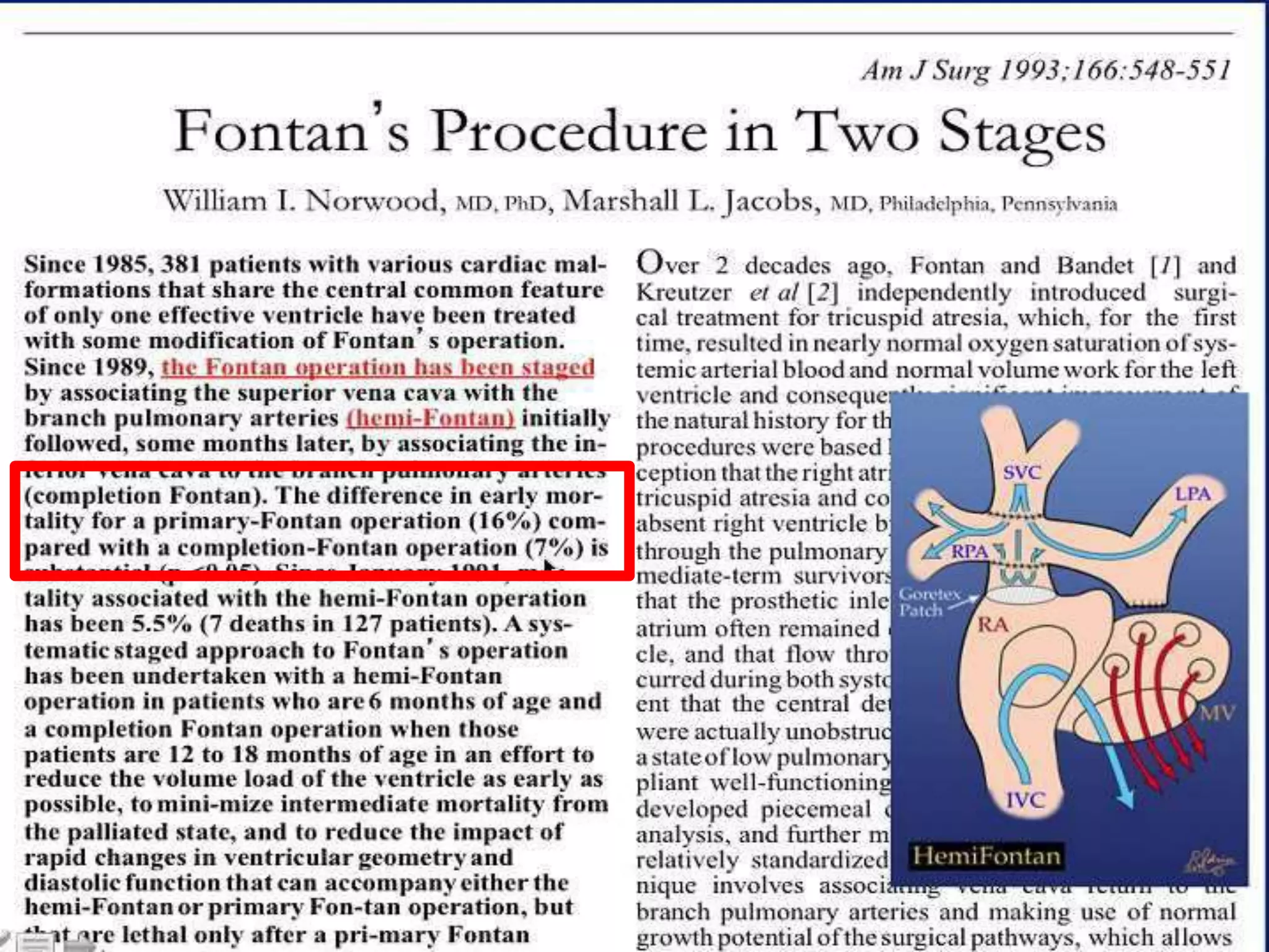 Fontan circulation | PPTX