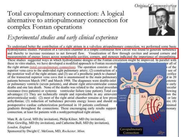 Fontan circulation | PPTX
