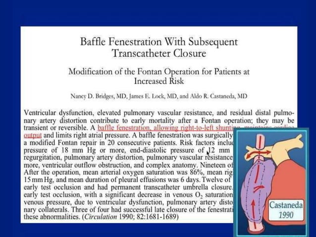 Fontan circulation | PPTX
