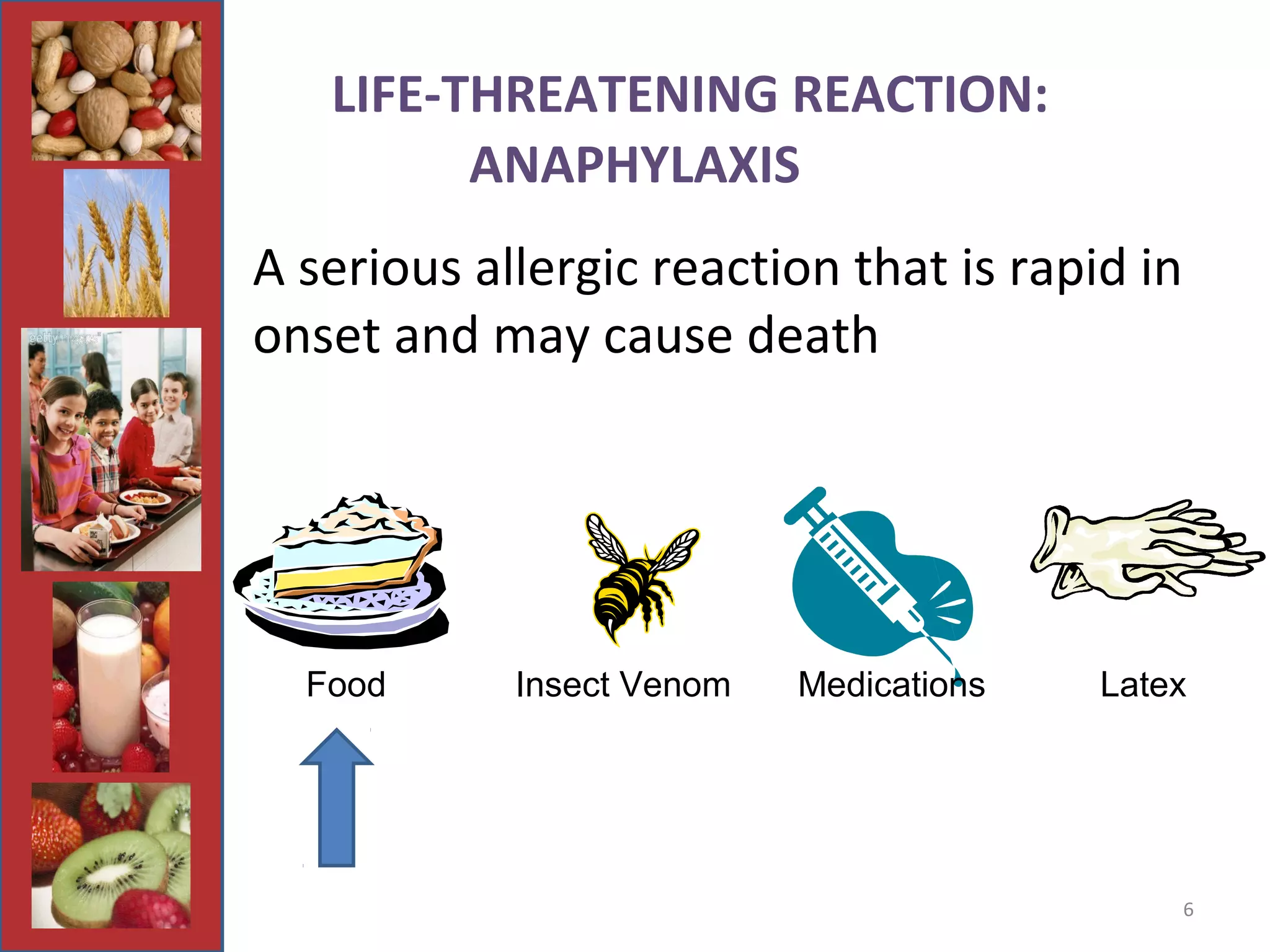 Food allergy-power point-presentation | PPT