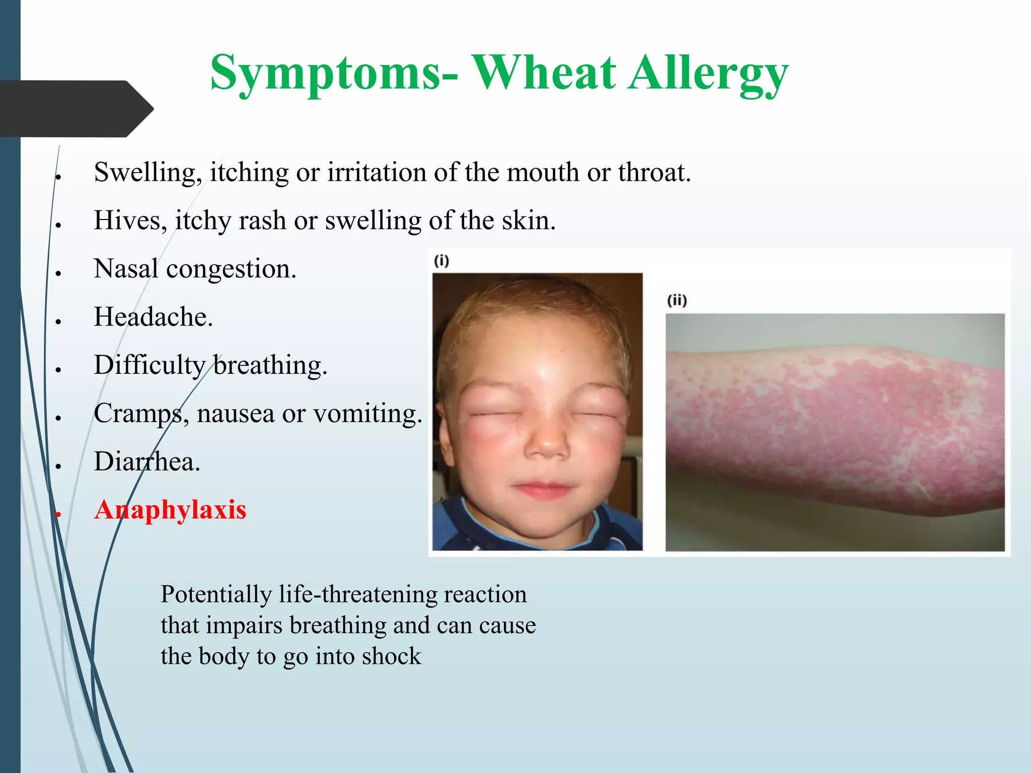 Food Allergen Overview | PPTX