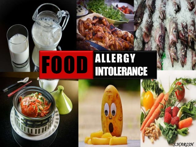 Food allergy & Intolerance | PPTX