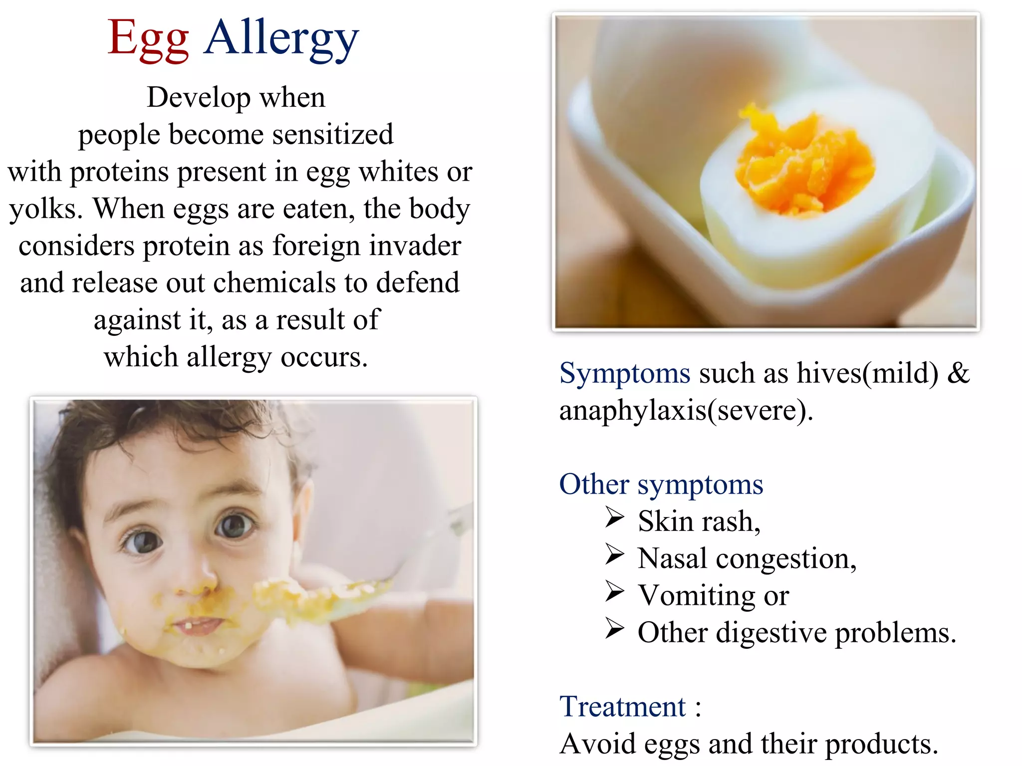 Food allergy | PPT