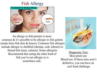 Food allergy | PPT