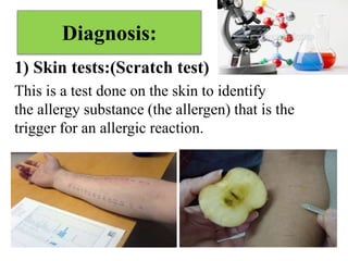 Food allergy, Al-nasser University Faculty of Medical Science | PPTX