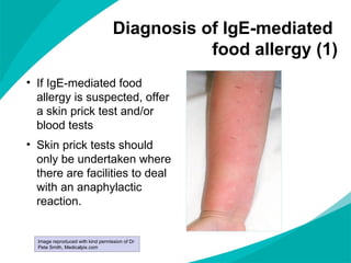 food allergy child and youg person.ppt ppt | PPT