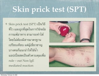 Food allergy slide | PDF