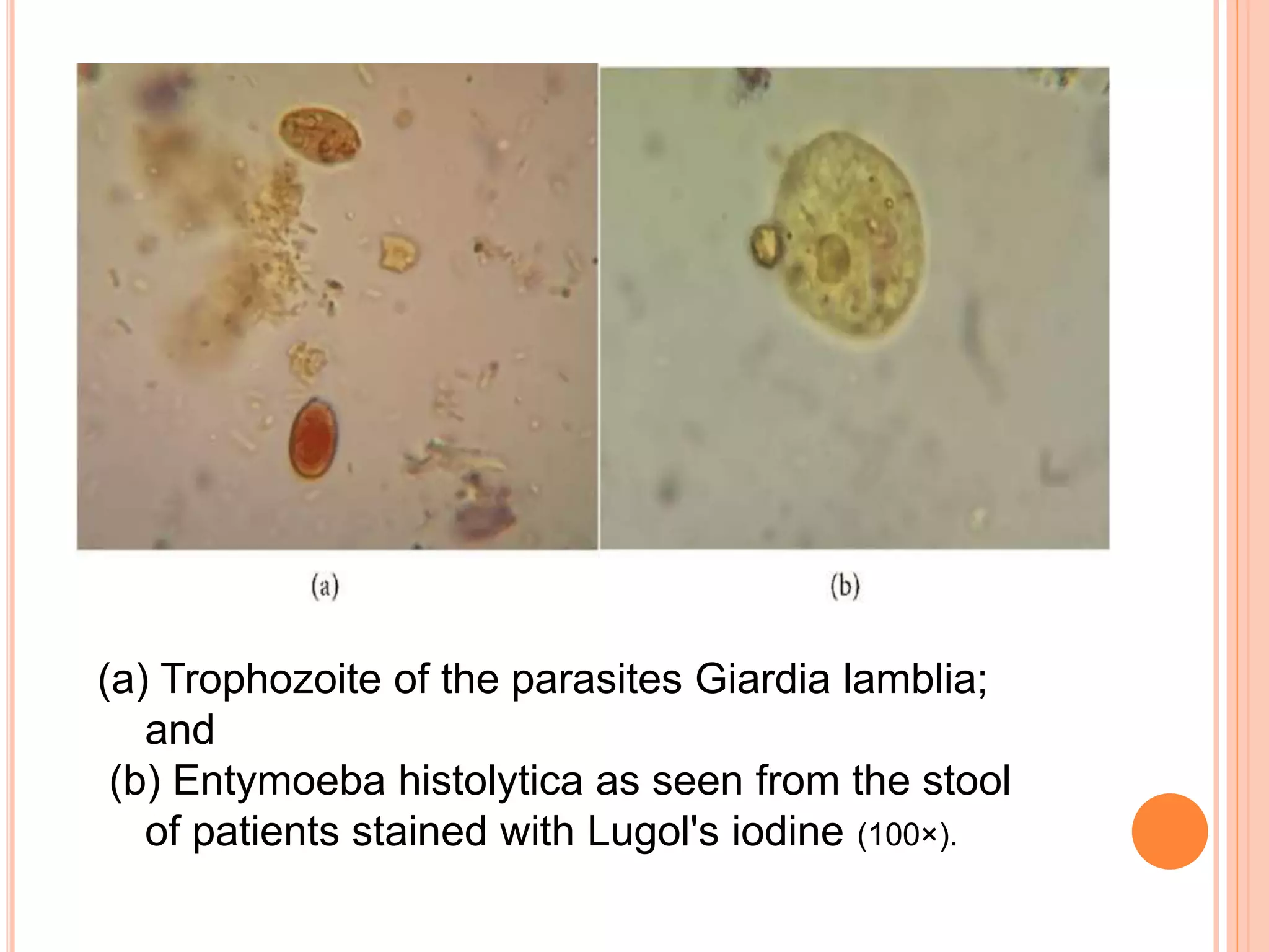 PARASITES STAINING METHODS | PPTX