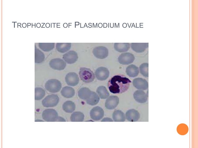 PARASITES STAINING METHODS | PPTX | Blood Disorders | Diseases and ...