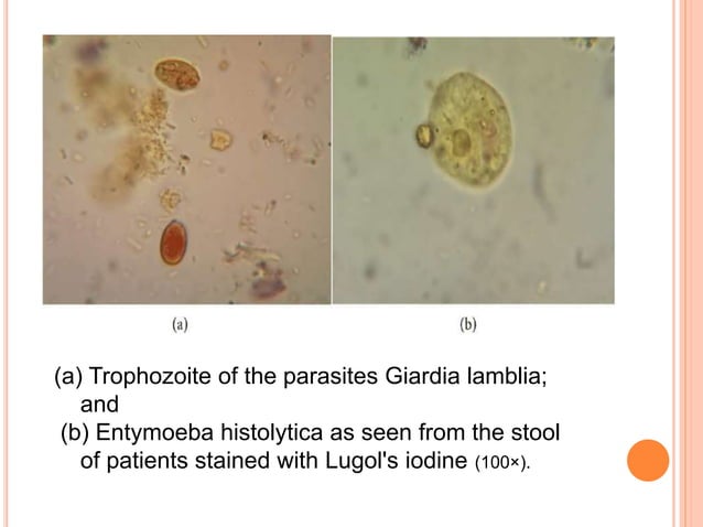 PARASITES STAINING METHODS | PPTX | Blood Disorders | Diseases and ...