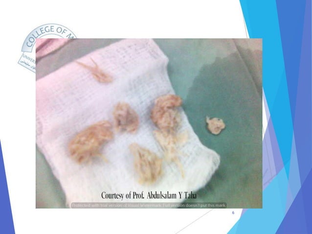 Food Bolus Impaction with Severe Dysphagia.pdf