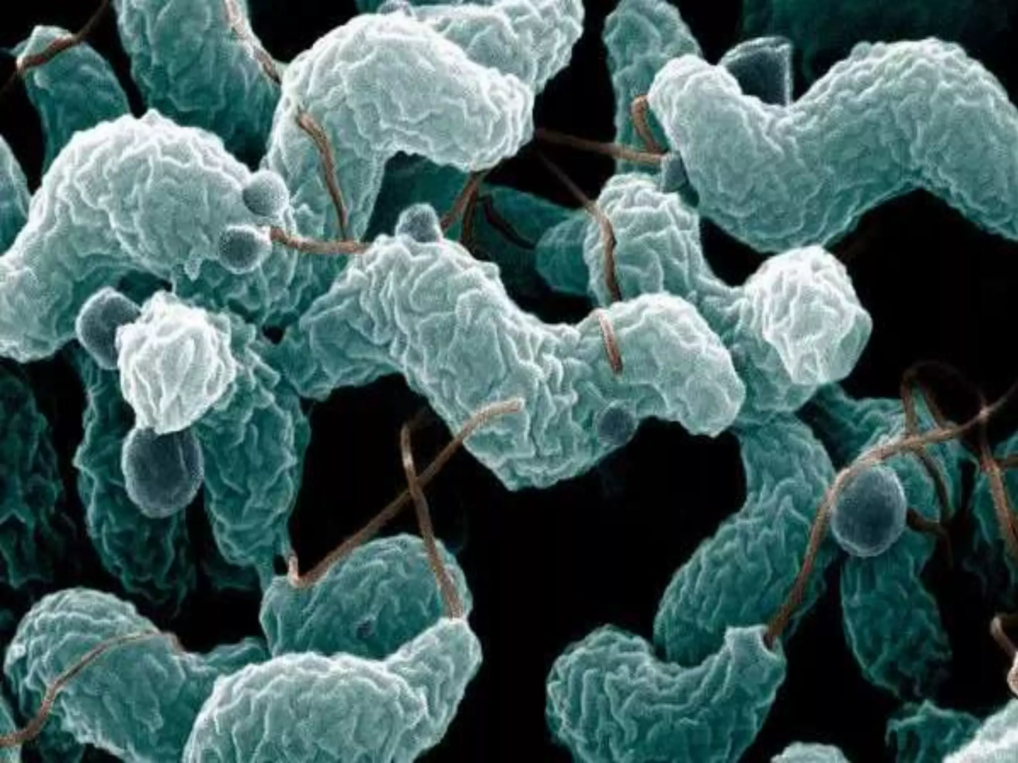 Food born diseases | PPTX