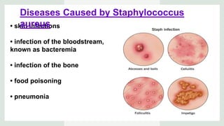 food born diseases #food infection and intoxication | PPTX | Digestive ...