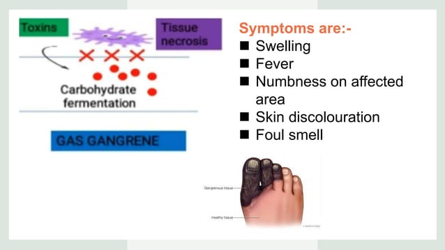 food born diseases #food infection and intoxication | PPTX | Digestive ...