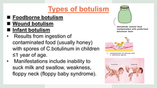 food born diseases #food infection and intoxication | PPTX | Digestive ...