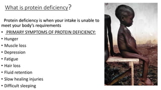 proteins food chemistry, its structure ,efficiency, deficiency, net ...