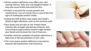 proteins food chemistry, its structure ,efficiency, deficiency, net ...