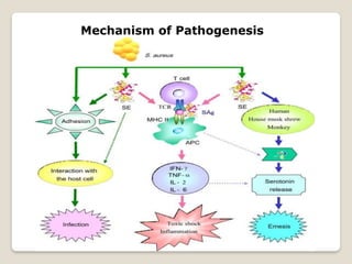 Staphylococcal species food intoxication.pptx
