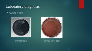 Food Microbiology lect on Campylobacter | PPTX