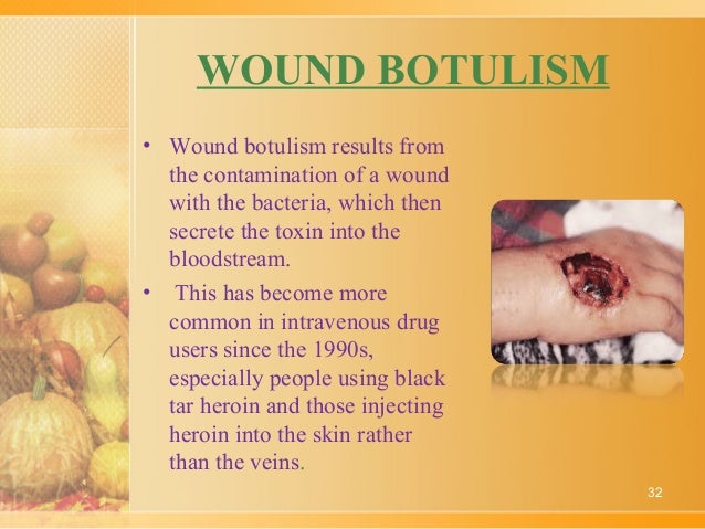 Wound Botulism Construction And Validation Of Safe Clostridium