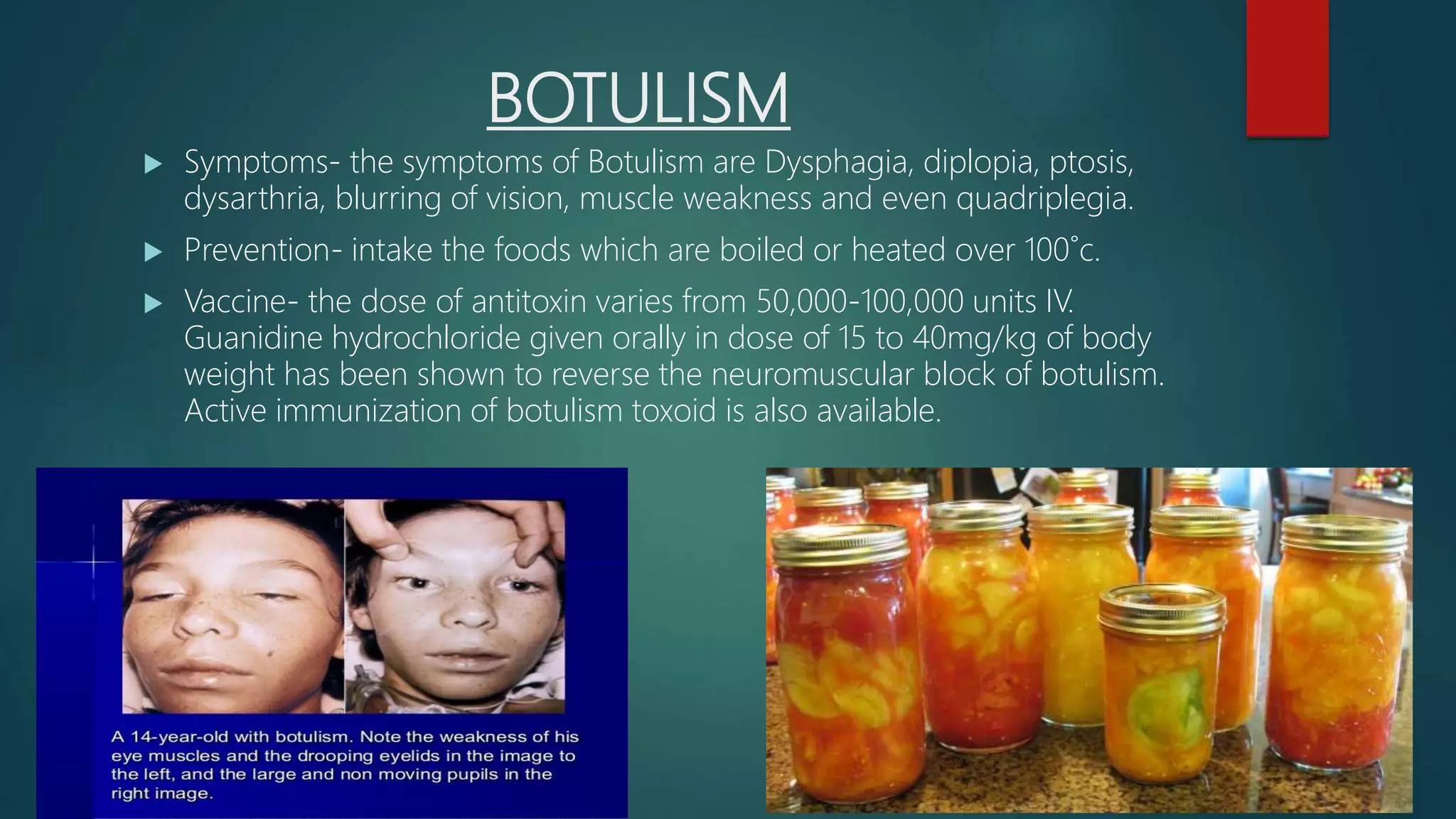 Food poisoning | PPTX