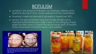 Food poisoning | PPT